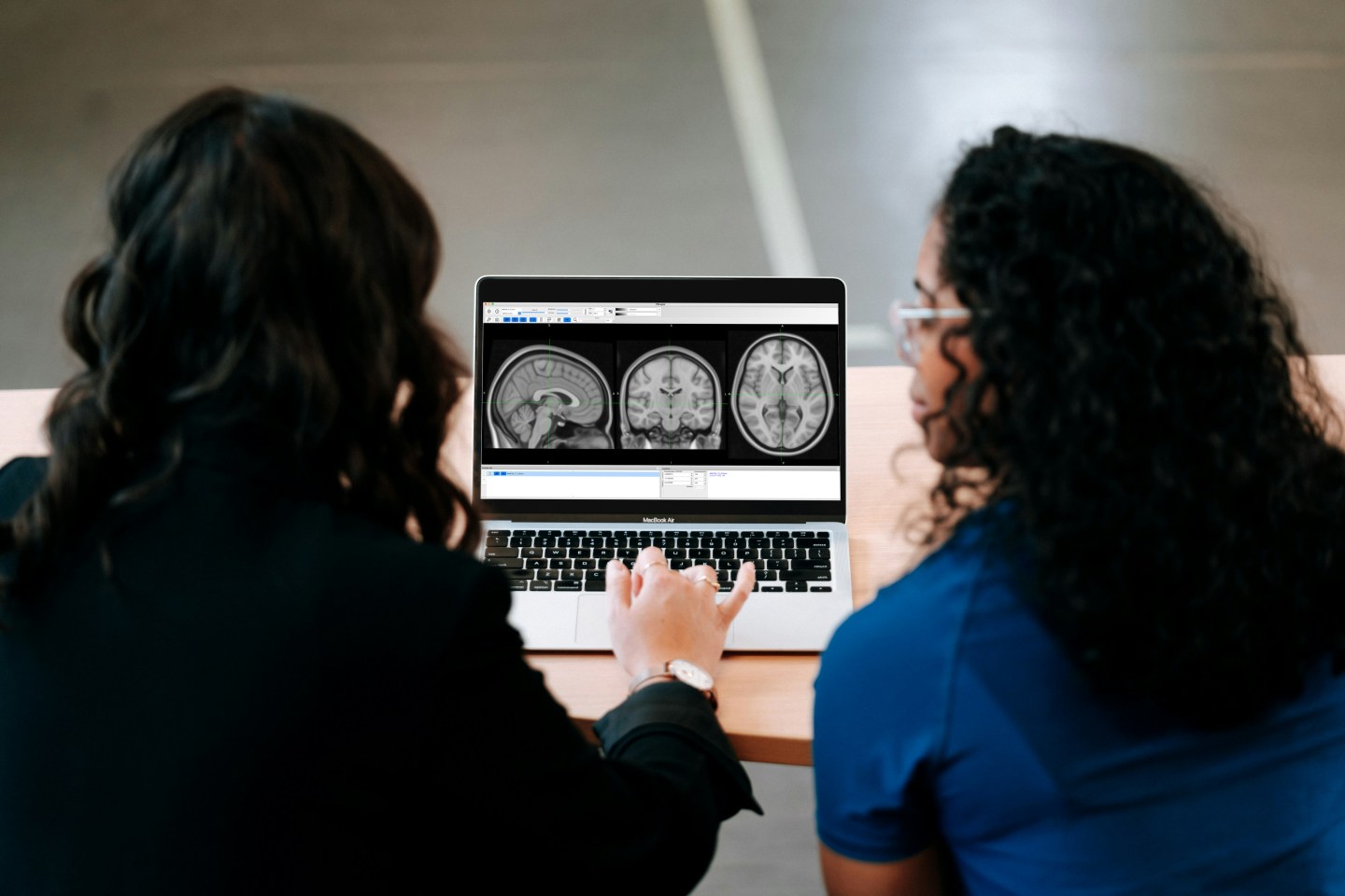 The Neurological Reasons Behind Common Brain Disorders Associated With ...